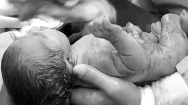 WATCH: Baby in Breech Position Has Bottom-First Gentle C-Section Birth