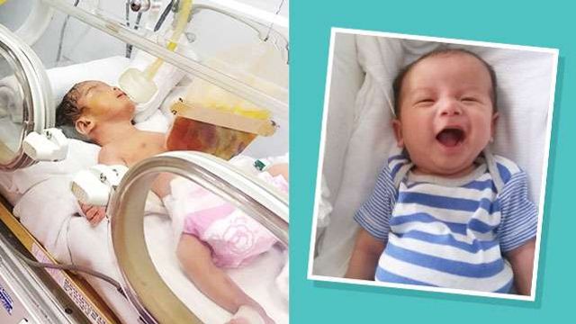 'My Baby Was Born With His Organs Sticking Outside of His Belly'